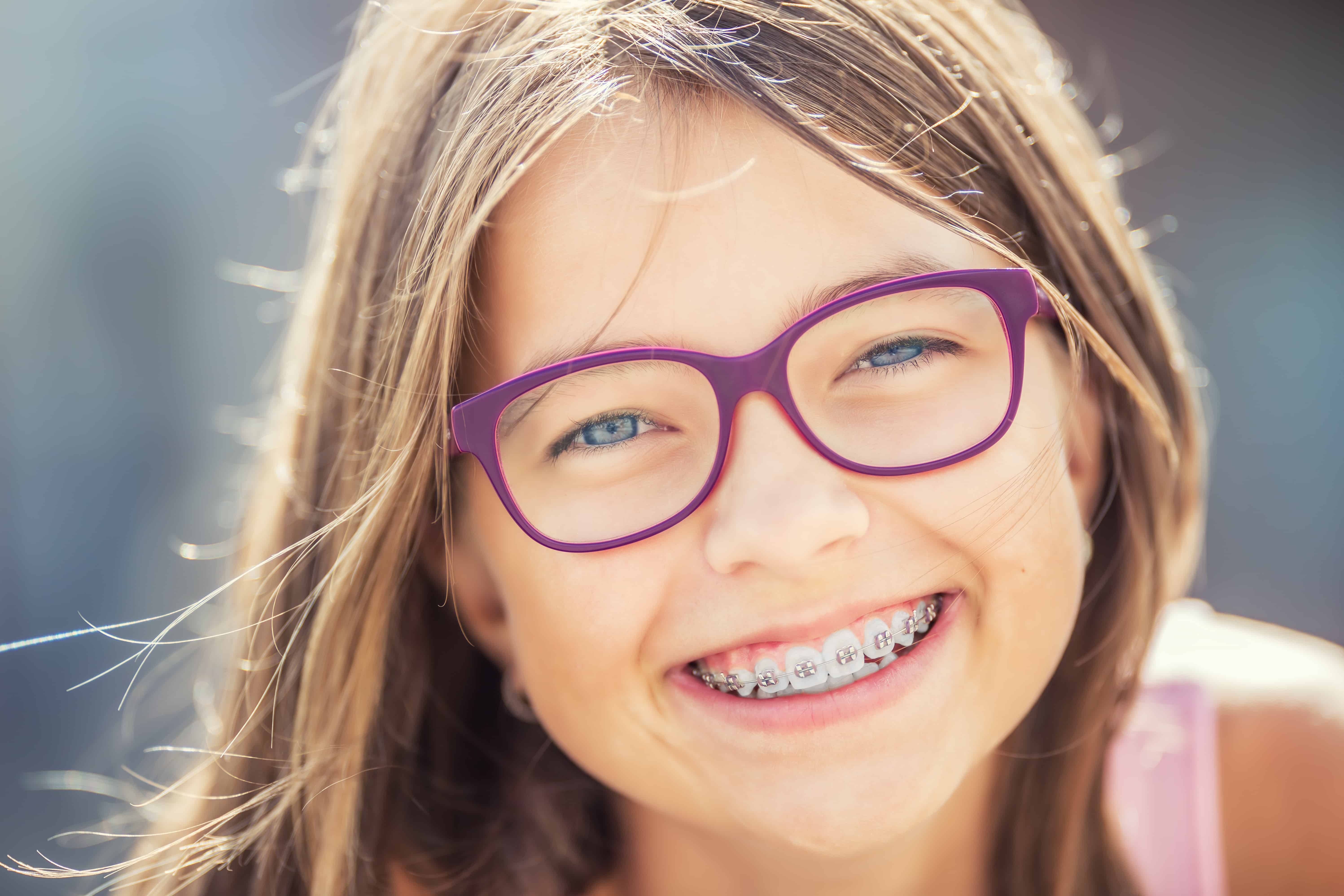How To Use Wax For Your Braces How To Use Orthodontic Wax For Braces 